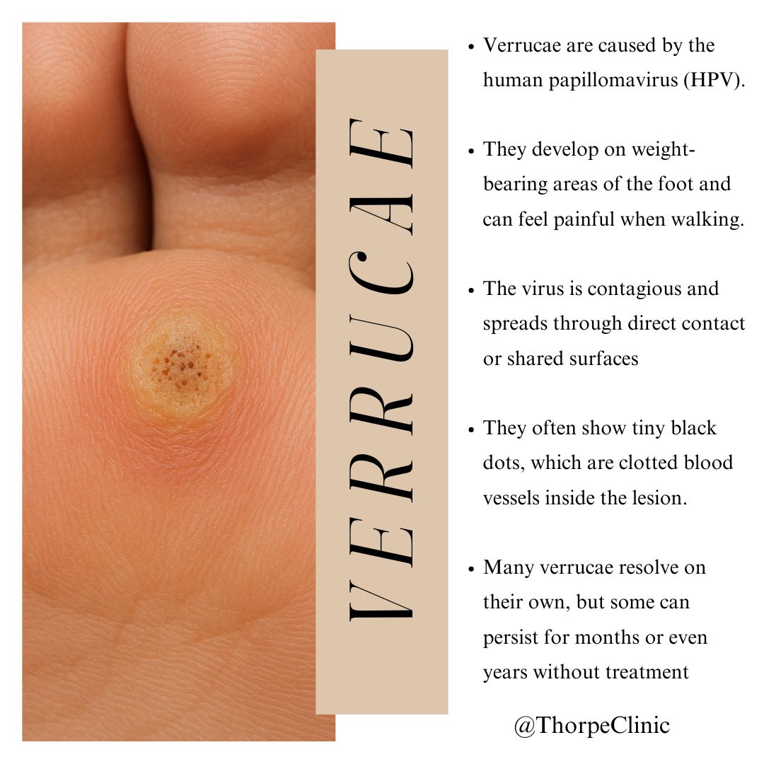 Inside Our Clinics | Thorpe Footcare Clinic Peterborough